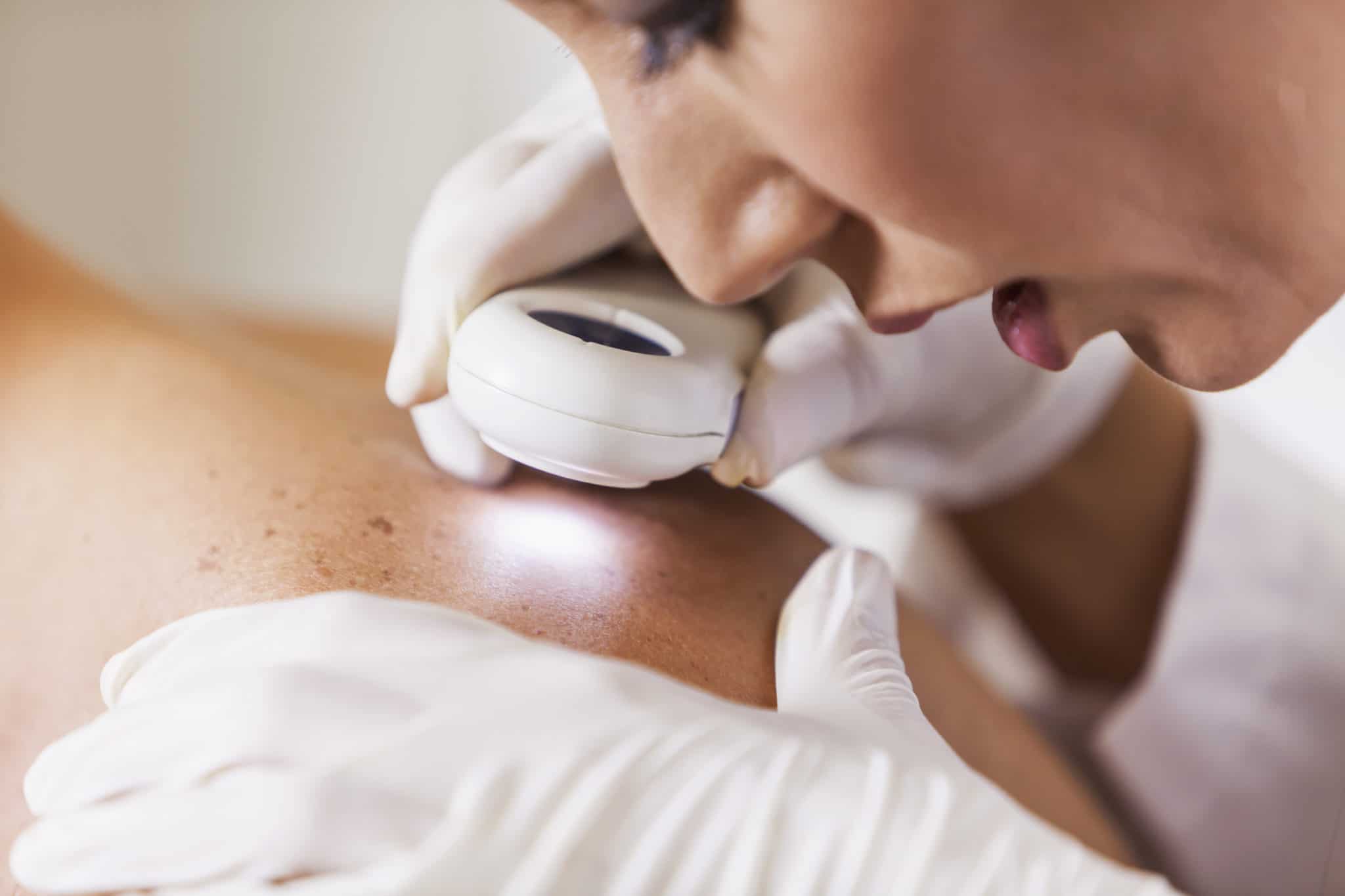 Your Skin Cancer Treatment and Support Team | Texas ENT Center